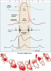 Wiggers Diagram Aortic Regurgitation
