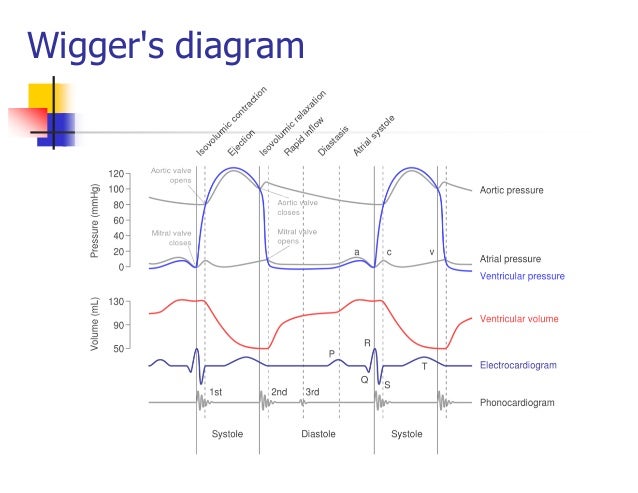 Wiggers Diagram Aortic Stenosis